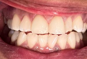 Smile Gallery - Fundamental Dental